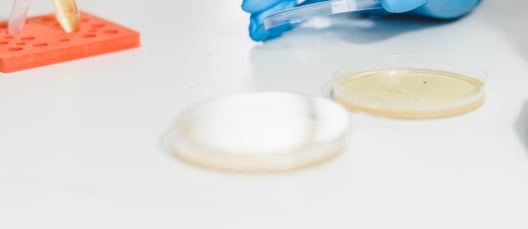 Restriction Enzyme Digestion Troubleshooting | Blog | ZAGENO