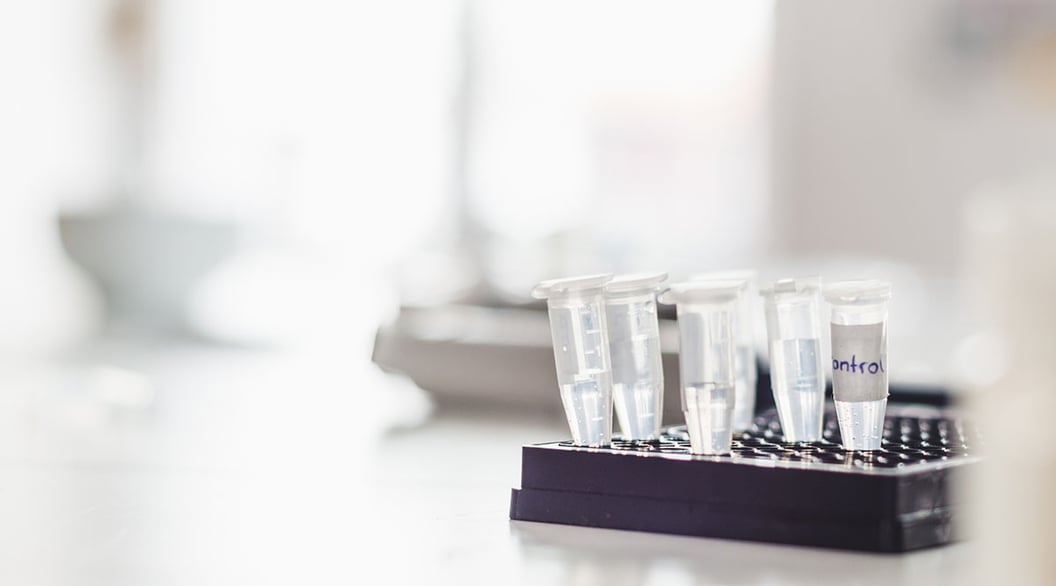 Plasmid Purification Troubleshooting | Blog | ZAGENO